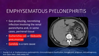Joint urology emphysematous pyelonephritis | PDF