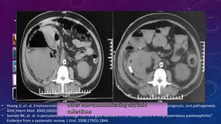 Joint urology emphysematous pyelonephritis | PDF | Blood Disorders ...