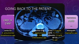 Joint urology emphysematous pyelonephritis | PDF | Blood Disorders ...