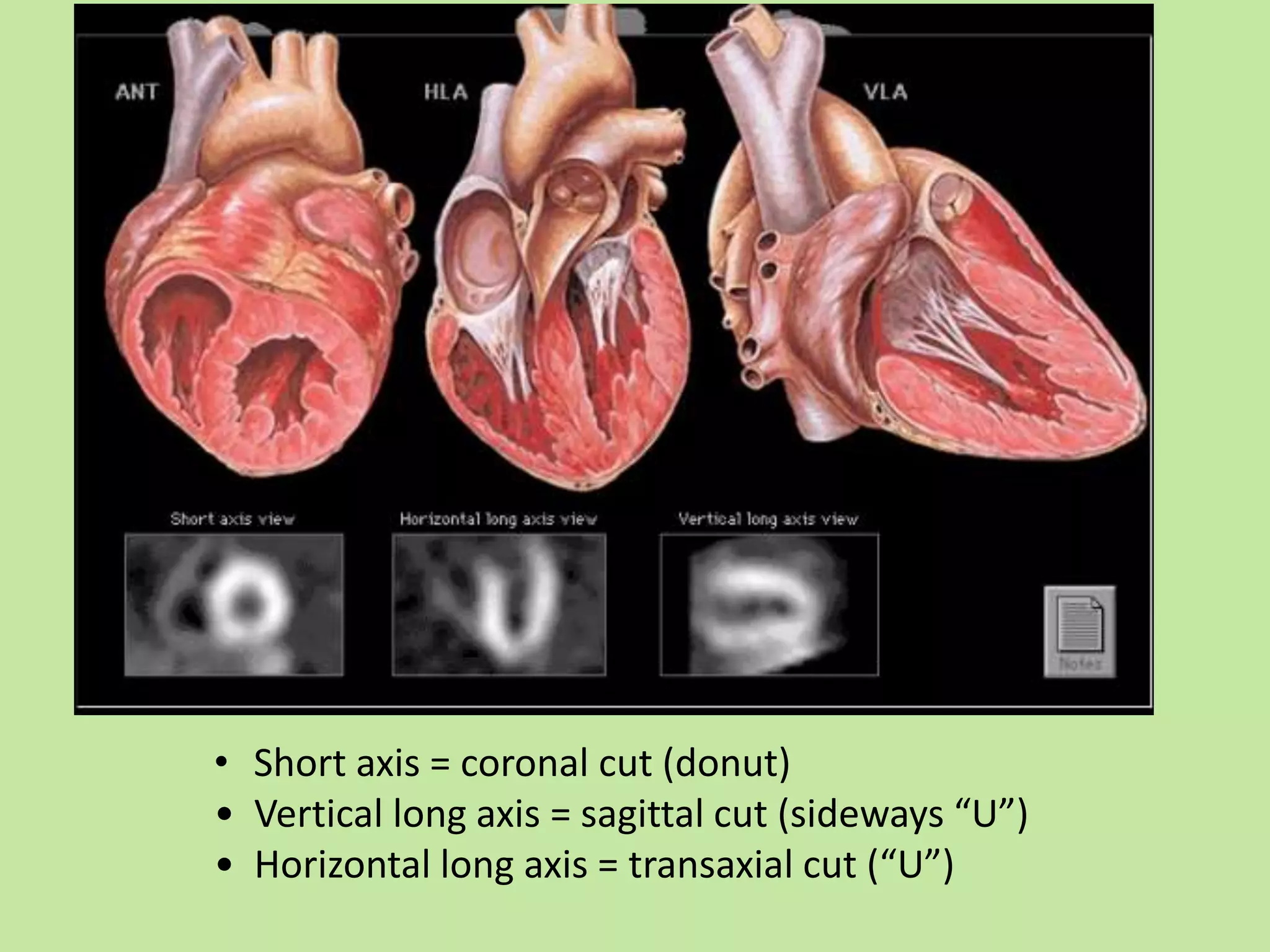 Nuclear imaging in cardiology | PPTX