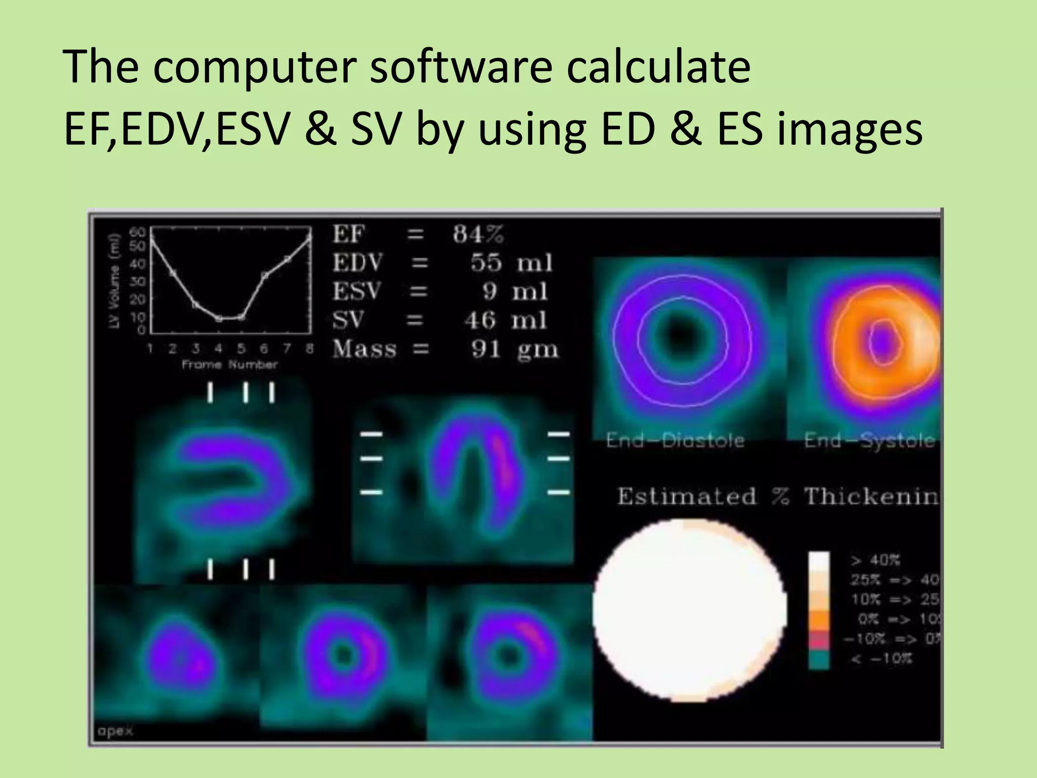 Nuclear imaging in cardiology | PPTX