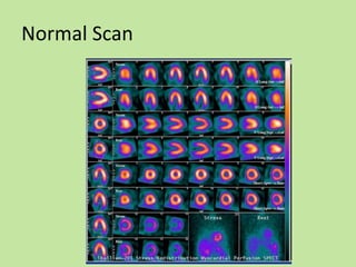 Nuclear imaging in cardiology | PPTX