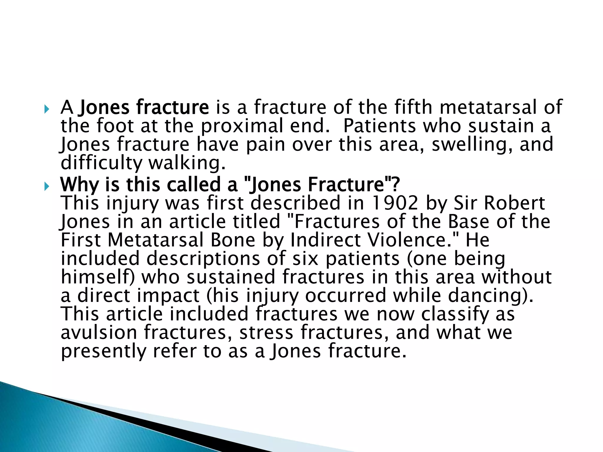 Jones Fracture | PPTX