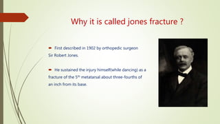 Jone's fracture by Dr.Mahbub | PPTX
