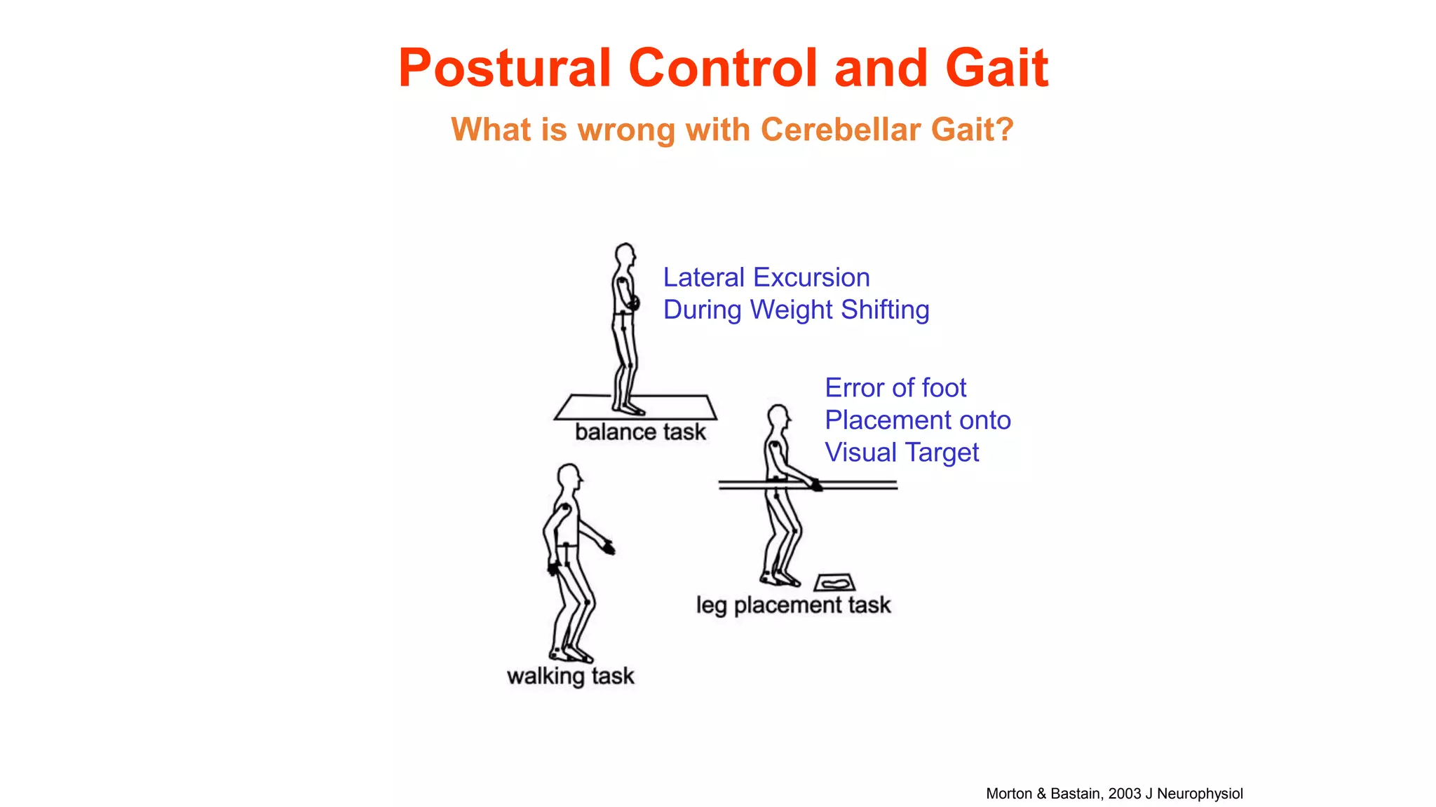 Cerebellar Ataxia in Multiple Sclerosis | PPTX
