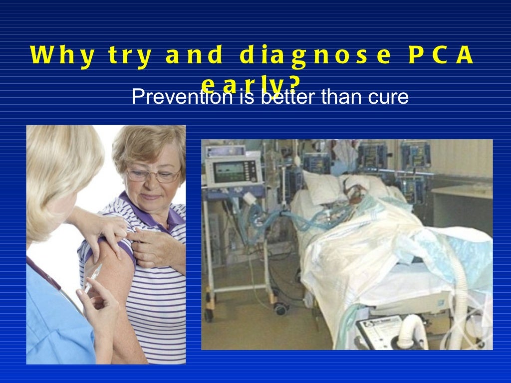 PCA Treatments by Jon Schott