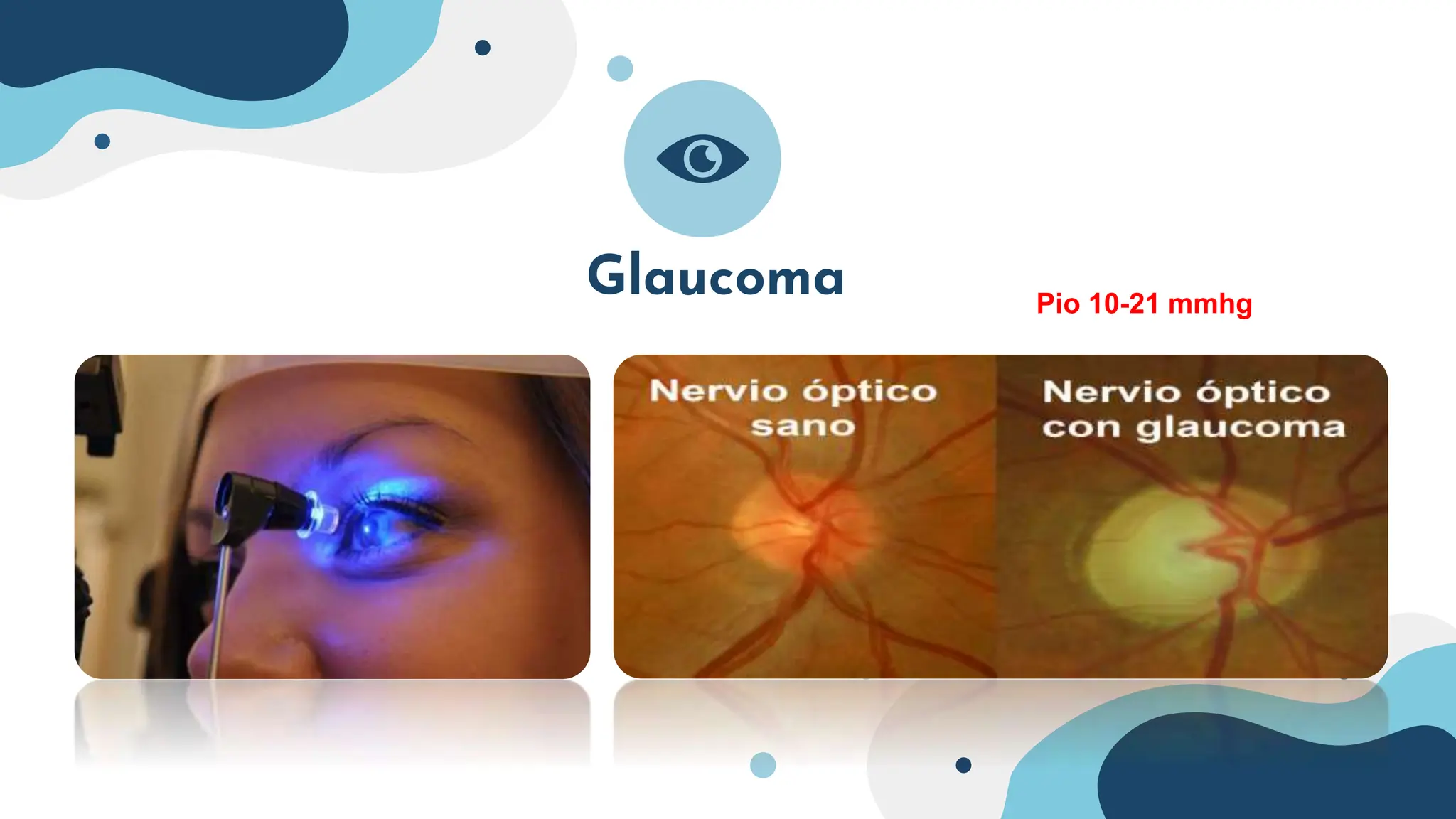 Jornada en Diabetes glaucoma.pptx | Diabetes | Diseases and Conditions