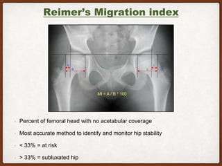Jose Austine- Orthopaedic evaluation of cerebral palsy | PPT