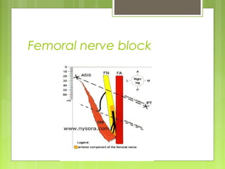 Ultrasound Guided Peripheral Nerve Blocks | PPT