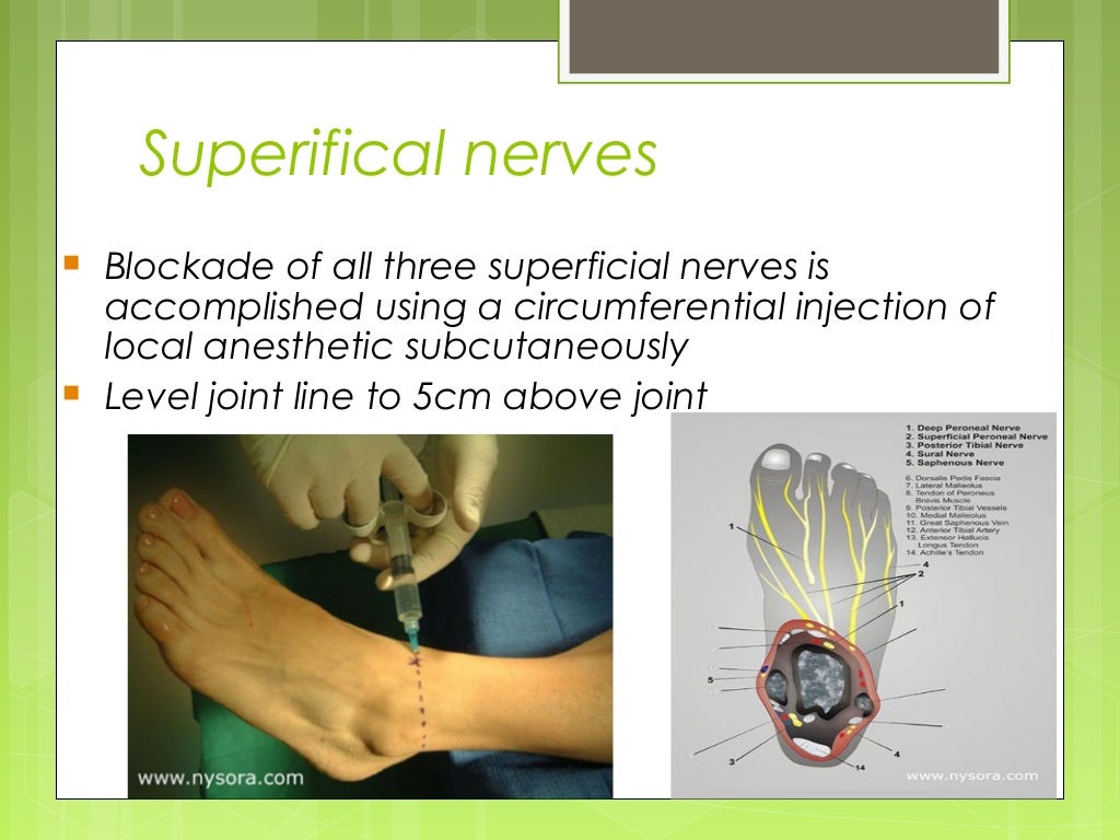 Ultrasound Guided Peripheral Nerve Blocks