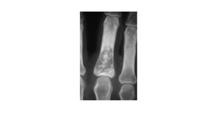orthopedic xrays and their reading pattern | PPT