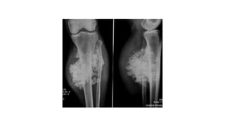 orthopedic xrays and their reading pattern | PPT
