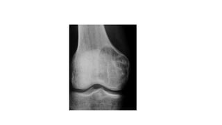 orthopedic xrays and their reading pattern | PPT