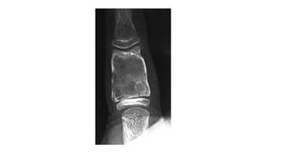 orthopedic xrays and their reading pattern | PPT