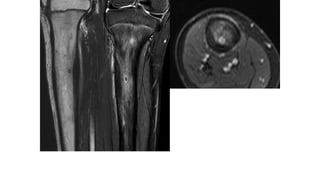 orthopedic xrays and their reading pattern | PPT