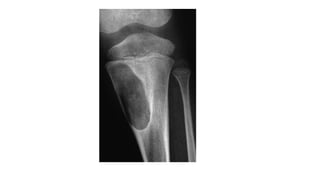 orthopedic xrays and their reading pattern | PPT