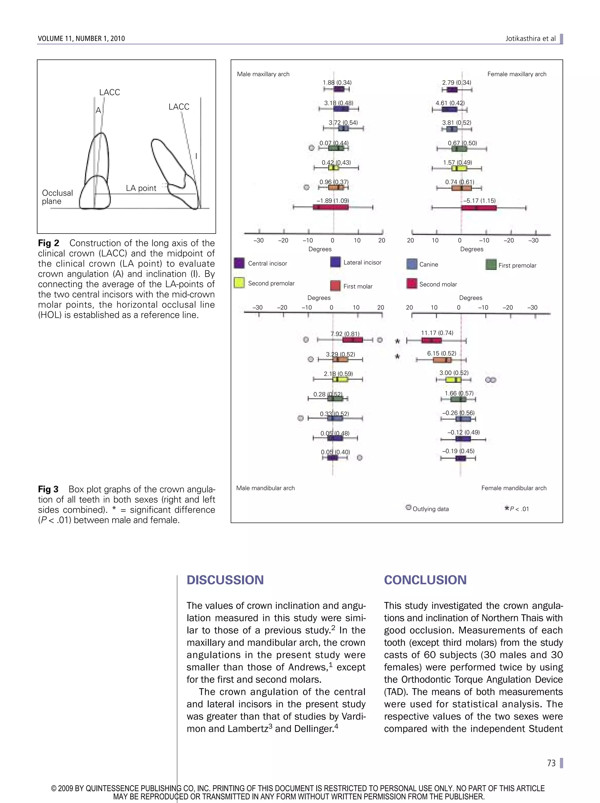 Crown Angulation and Inclination with good occlusion | PDF