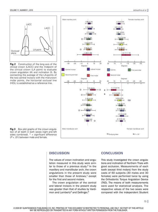 Crown Angulation and Inclination with good occlusion | PDF