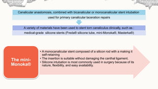 Jourding-Etiology and prognosis of canalicular.pptx