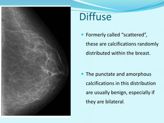 Microcalcifications in Carcinoma Breast | PPTX