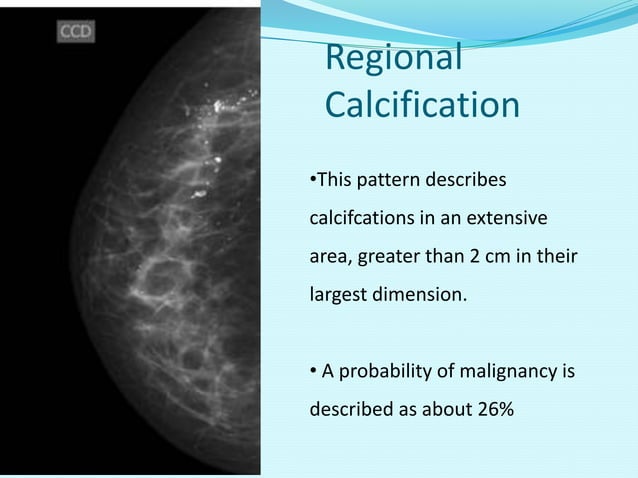 Microcalcifications in Carcinoma Breast