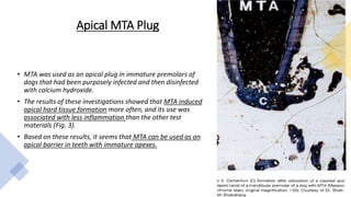 CLINICAL APPLICATIONS OF MTA | PPTX