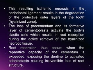 Effect of Orthodontic Mechanotherapies on Extrnal Root Resorption | PPT