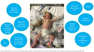 PICU Fever Algorithm- Journal Club | PPT
