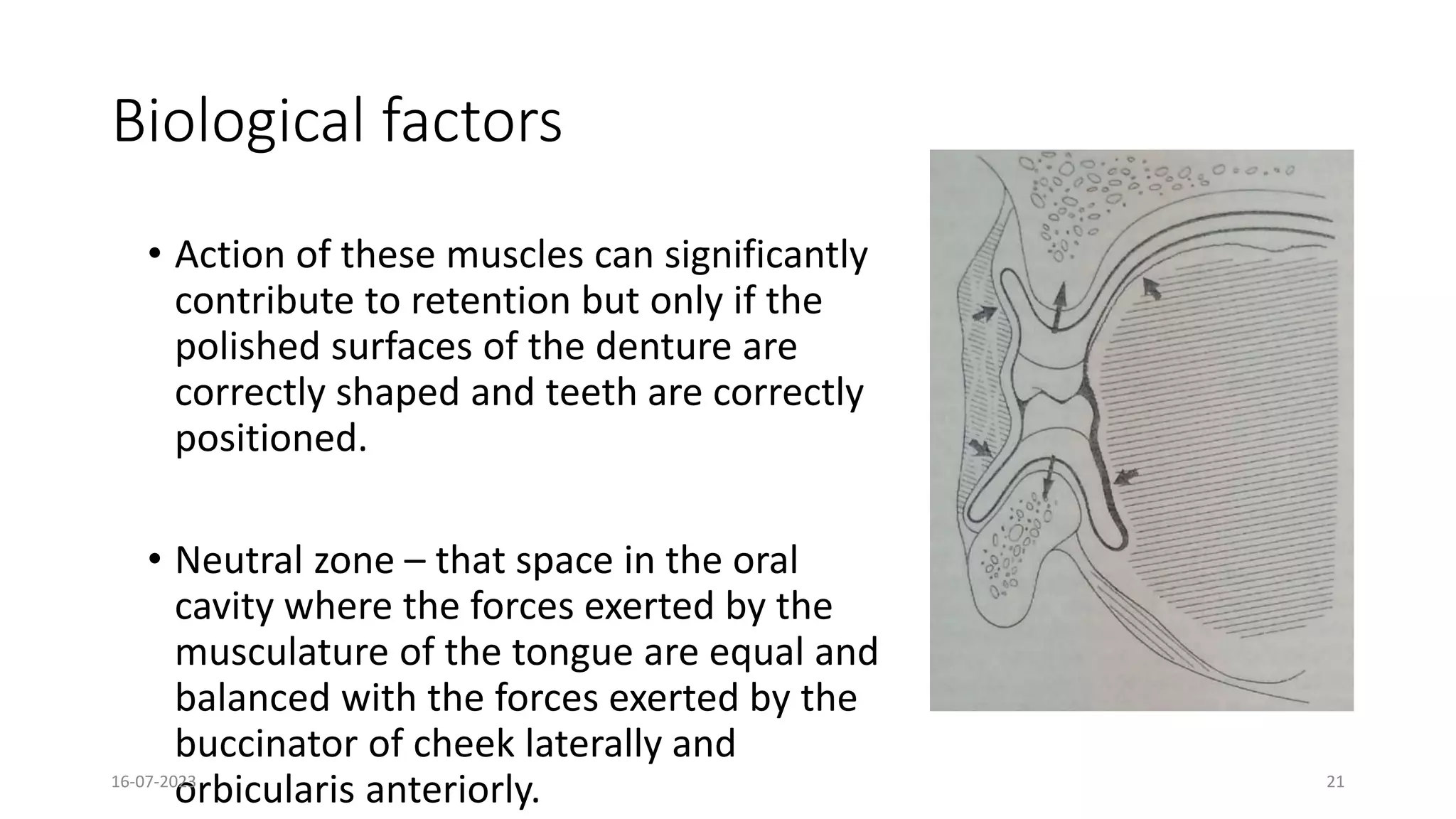 JOURNAL CLUB on retention in complete denture | PPTX
