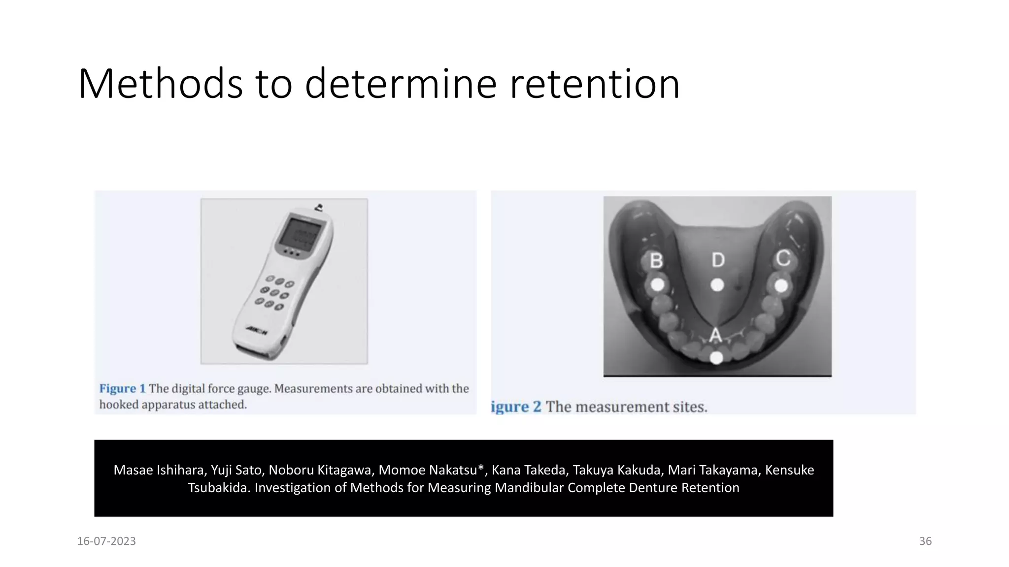 JOURNAL CLUB on retention in complete denture | PPTX