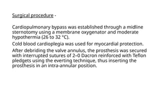 Journal club on TTK Chitra valve TM.pptx
