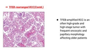 NEW UPDATES IN KIDNEY TUMOR PATHOLOGY: WHO 5th EDITION.pptx