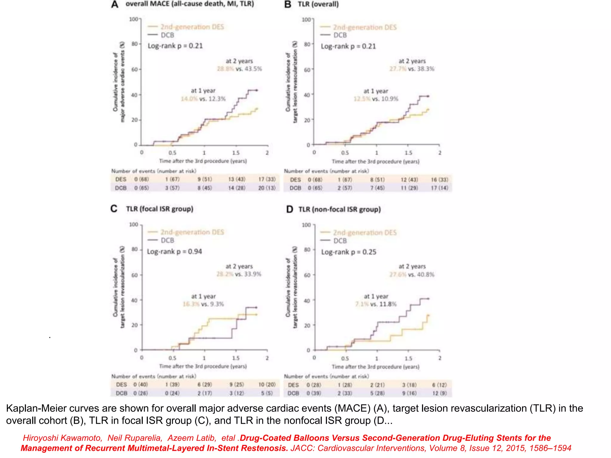 Journal club drug eluting balloon for cad | PPTX