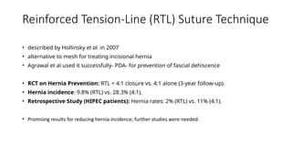 journal club- Reinforced Tension Line suture.pptx