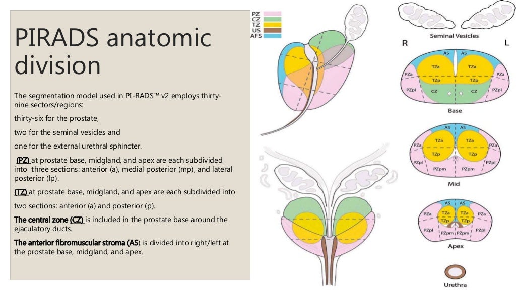 PROSTATE MRI IMAGING - PIRADS V2 2015