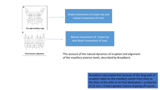 Etiology of maxillary canine impaction | PPT