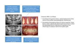 Etiology of maxillary canine impaction | PPT
