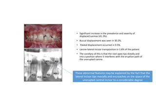 Etiology of maxillary canine impaction | PPT