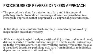 JOURNAL CLUB 2 endoscopic reverse denkers approach.pptx