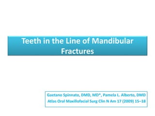 Teeth in fracture line | PPTX