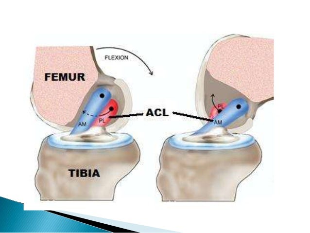 acl arthroscopic reconstruction single bundle vs double bundle