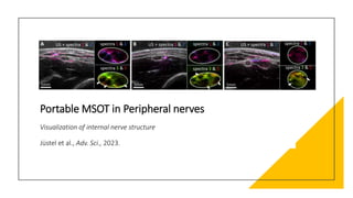 journal club_Chadi Ibrahim_ july.1st.2024.pptx