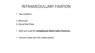 Journal club by Dr. Amit Motwani distal end radius | PPTX