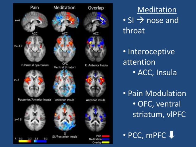 Brain Mechanisms, Pain Modulation, & Mindfulness Meditation | PPTX