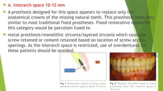 Journal club interarch distance attachments Prosthodontics | PPT