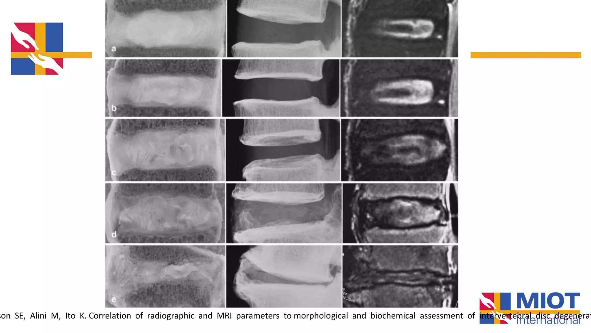 Journal club | PPTX