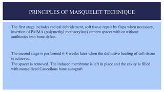 Masquelet technique for management of fracture non union | PDF
