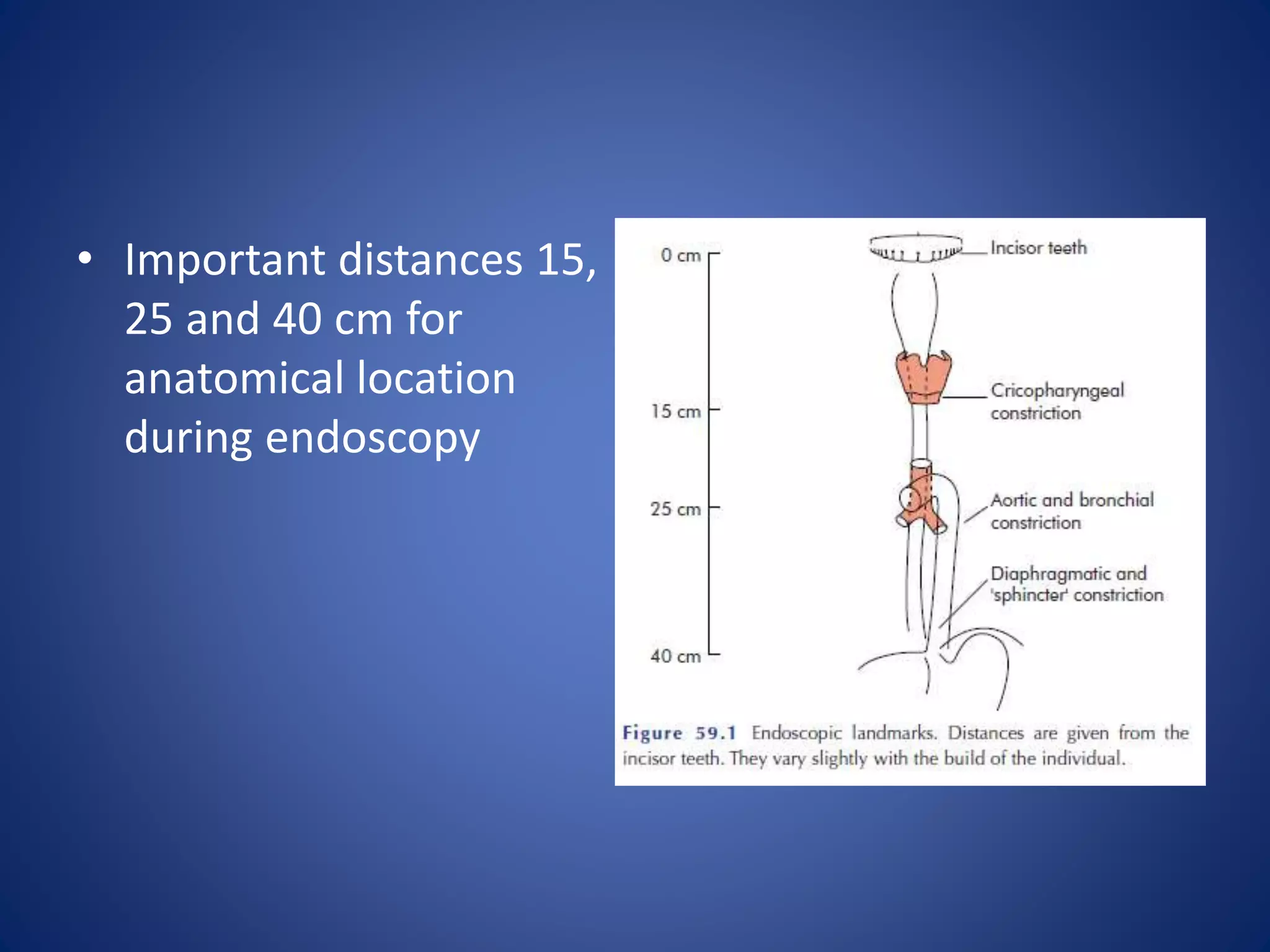 Journal club oesophageal motility disorders and manometry | PPTX