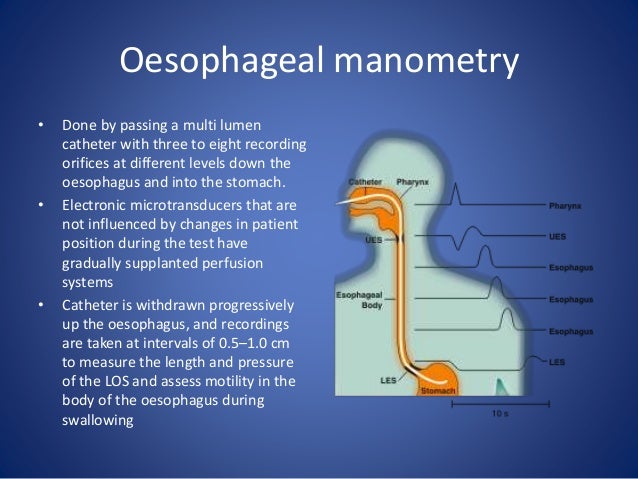 Journal club oesophageal motility disorders and manometry
