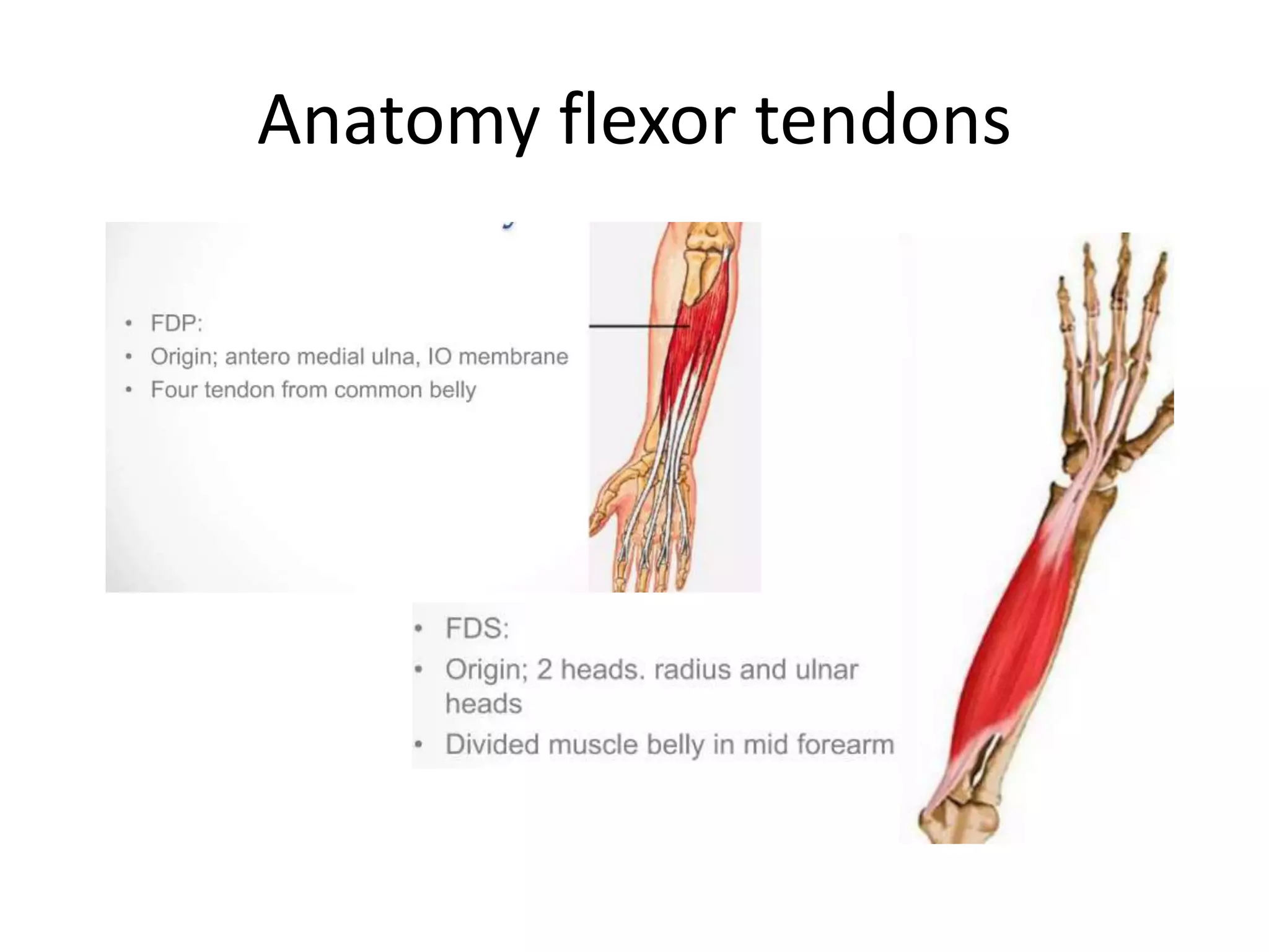 JOURNAL CLUB ON FLEXOR TENDON INJURIES.pptx